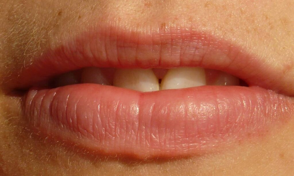 Por que os lábios ficam ressecados? – Zona Curiosa