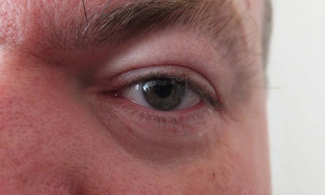 Por que nossas pálpebras ficam pesadas quando estamos cansados? – Zona ...