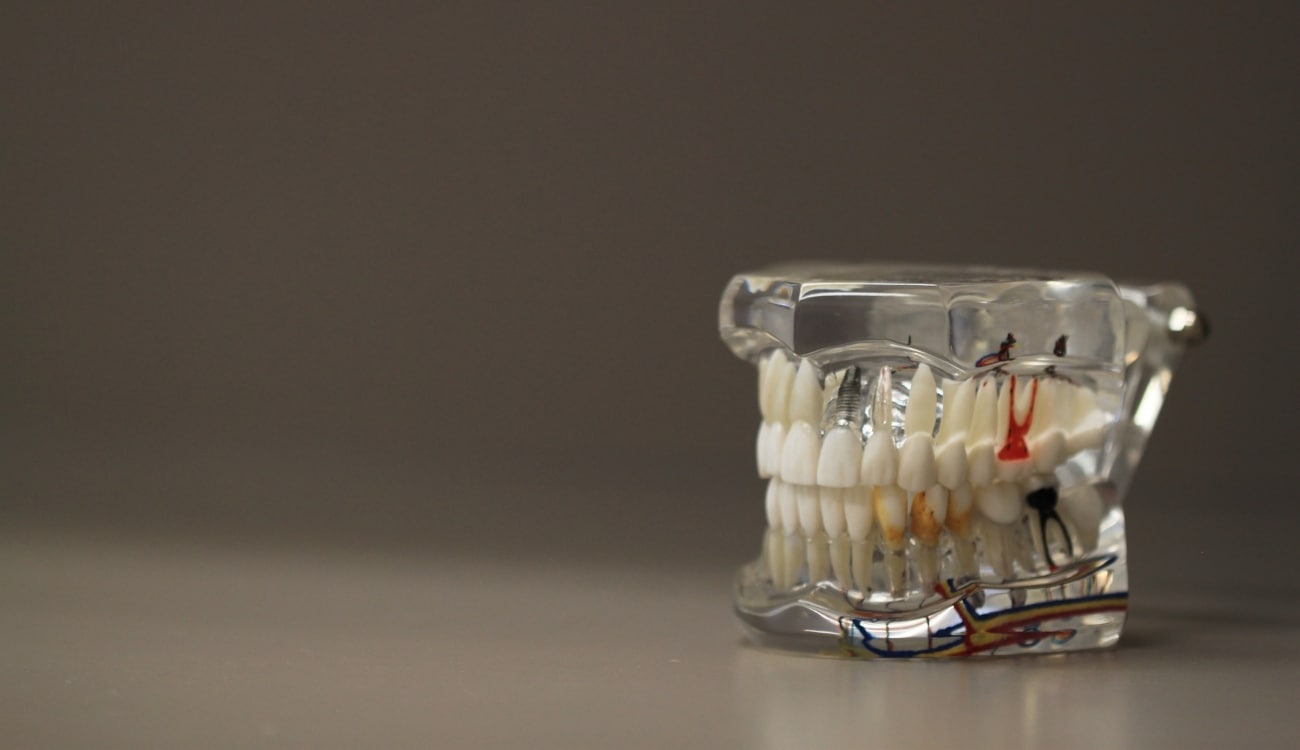 Por que temos um dente siso? – Zona Curiosa